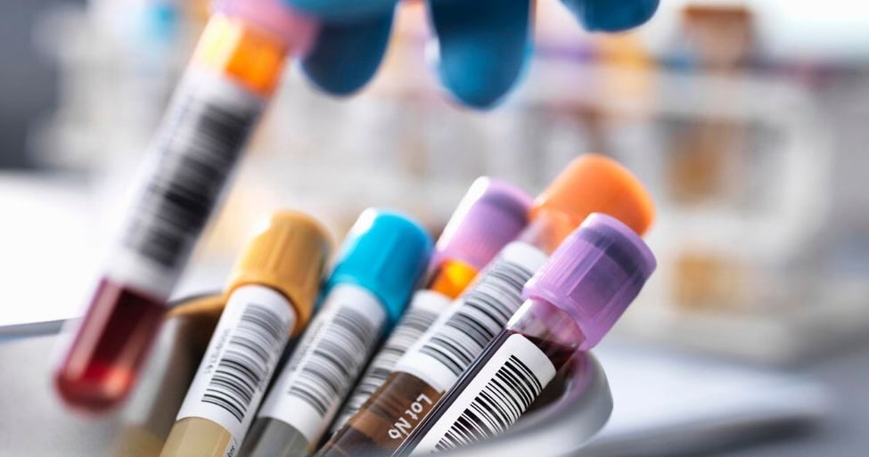 What is a Full-Service CRO? A Comprehensive Guide